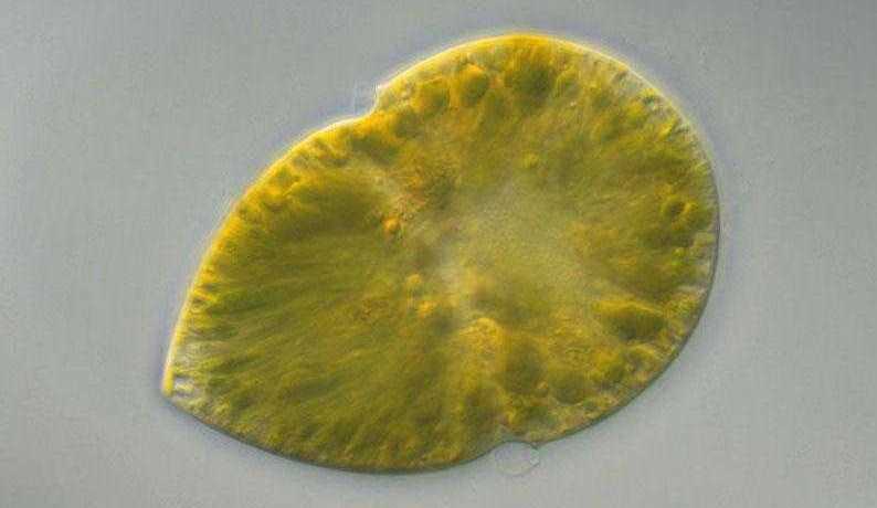 mixo.html 28_Gymnodinium.jpg